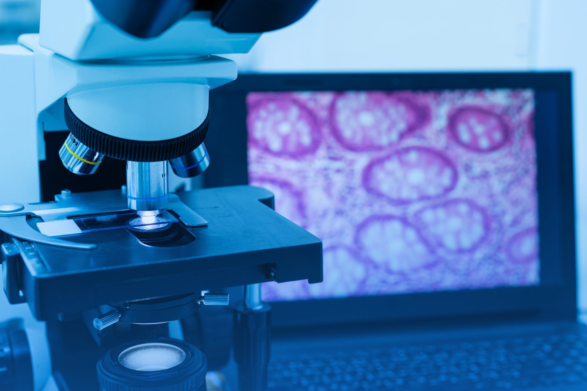 Projects | Friends of Cancer Research